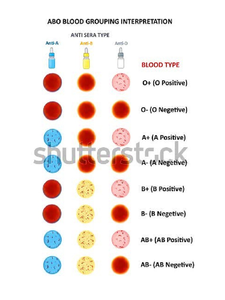 Interpretacion Del Grupo Abo | PDF