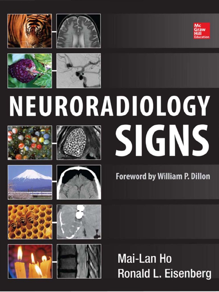 Neuroradiology Signs | PDF