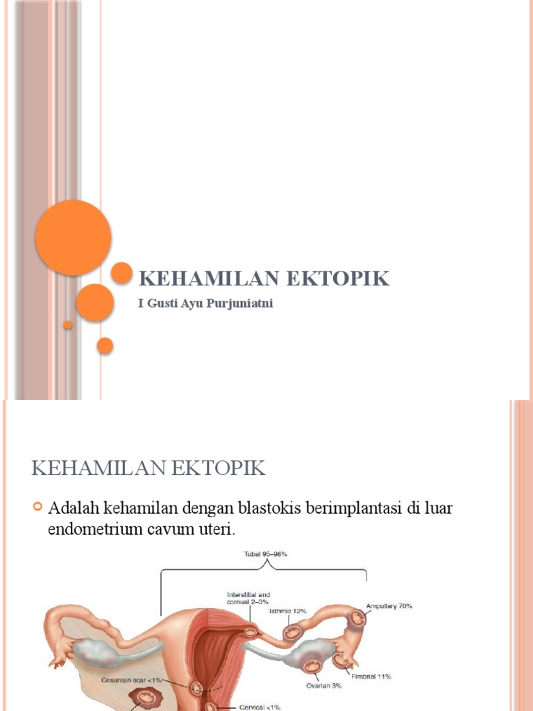 Kehamilan Ektopik | PDF