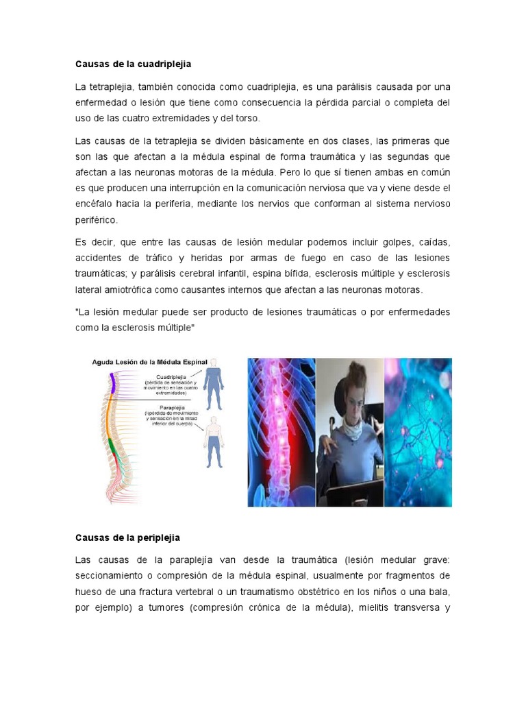 Causas de La Cuadriplejia | PDF | Sistema nervioso central | Anatomía ...