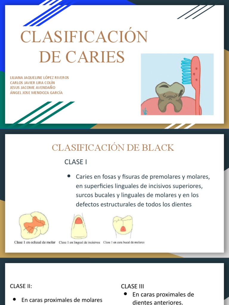 Clasificación de Caries | PDF