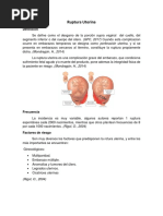 Maniobra de Ritgen | PDF | Parto | Reproducción