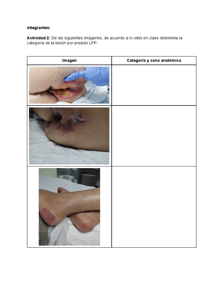Clasificacion de LPP | PDF