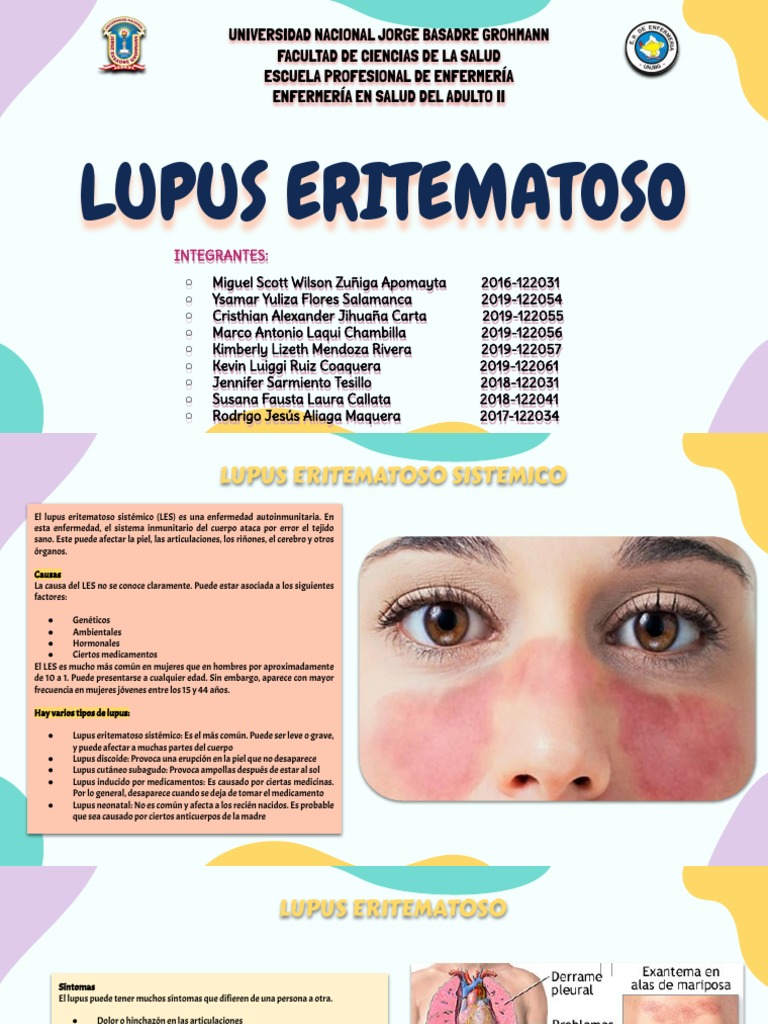 Lupus Eritematoso | PDF | Corticosteroides | Epidemiología