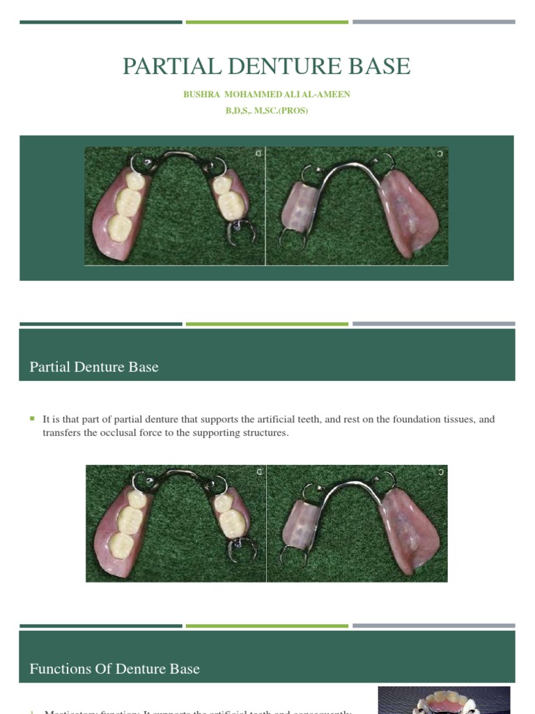 15) Partial Denture Base | PDF | Dentures | Dentistry Branches