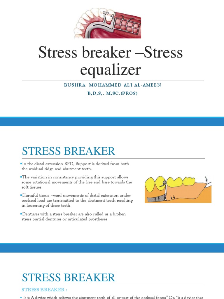 Types and Benefits of RPD Stress Breakers | PDF | Dentures | Dentistry ...