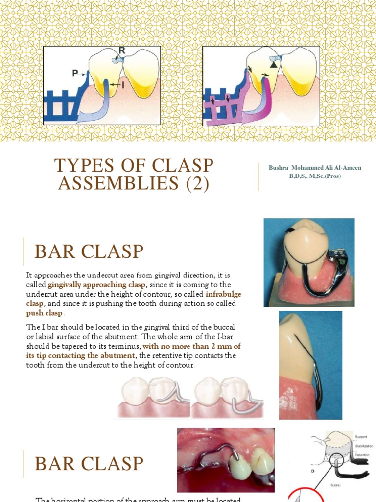 12) Types of Clasp Assemblies | PDF | Dentistry Branches