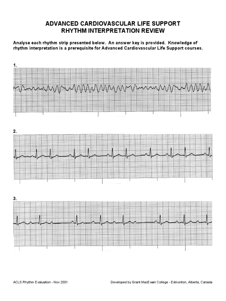 Rhythm Strip Review | PDF