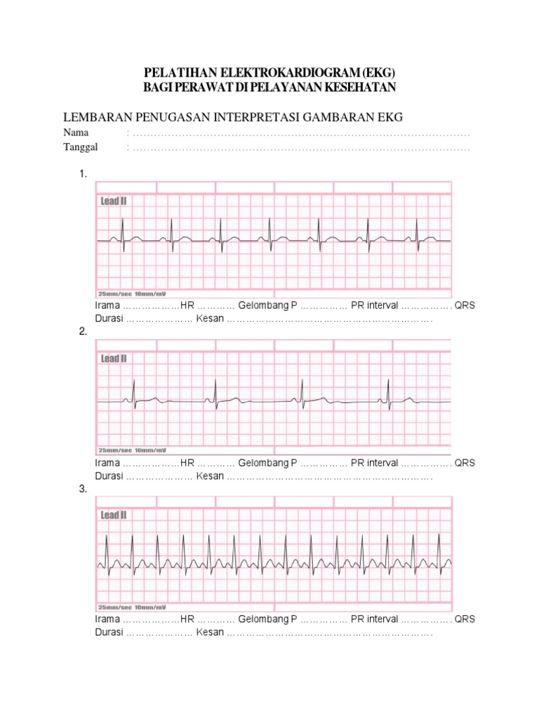LEMBARAN PENUGASAN Interpretasi Gambaran EKG | PDF