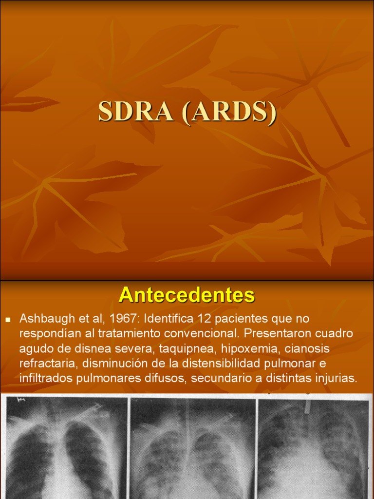 Criterios y manejo del SDRA | PDF | Insuficiencia cardíaca | Neumonía