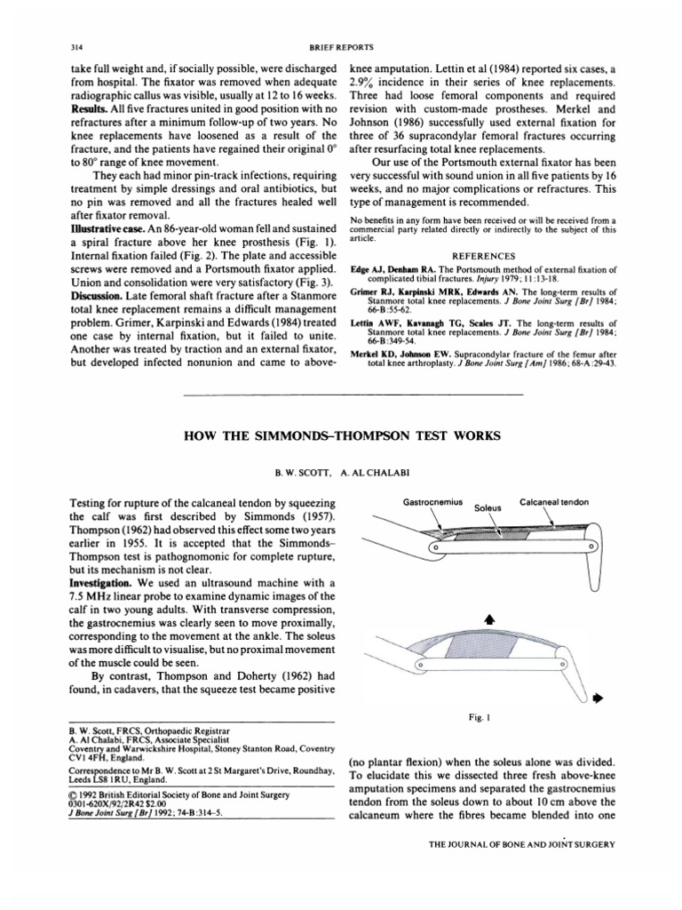 Results. All Five Fractures United in Good Position With No: HOW THE ...