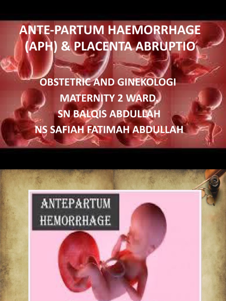 Management of Antepartum Hemorrhage | PDF | Childbirth | Fetus