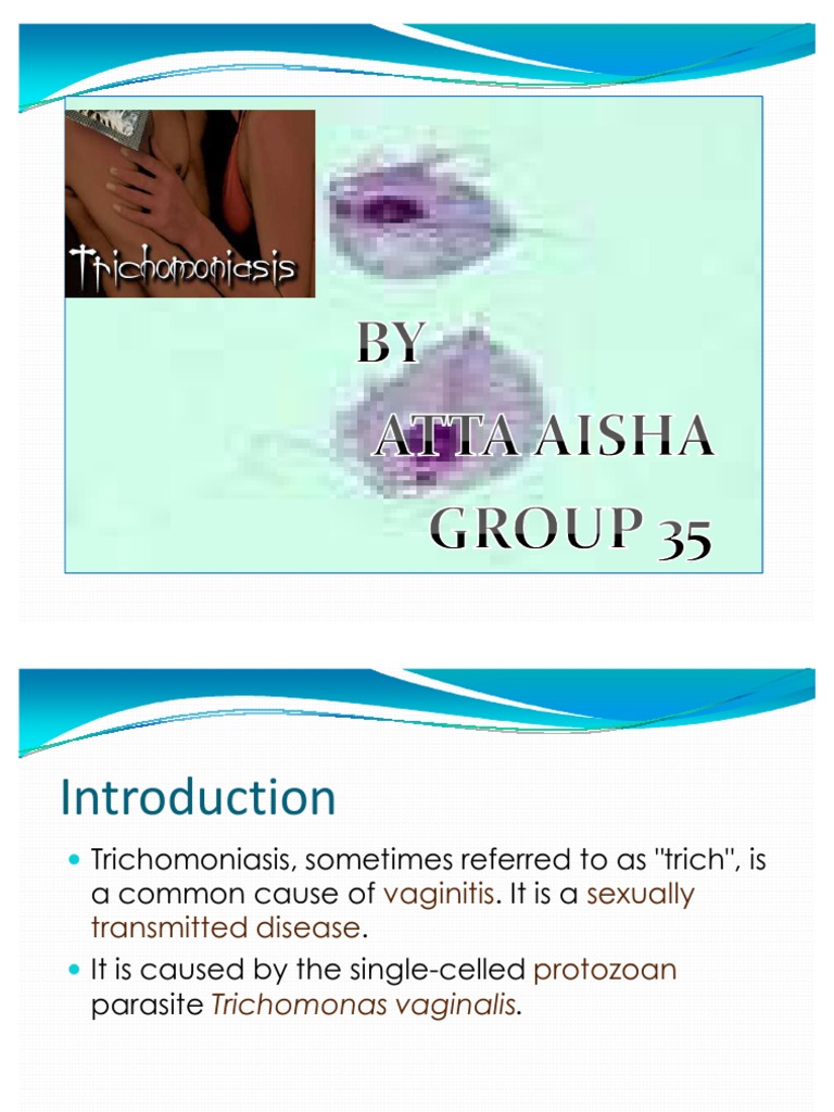 Trichomoniasis | PDF
