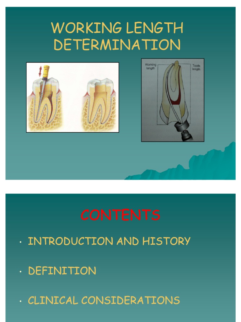 Working Length Determination Methods | PDF