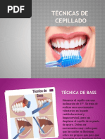 Técnica de Bass Modificada | PDF | Diente | Odontología