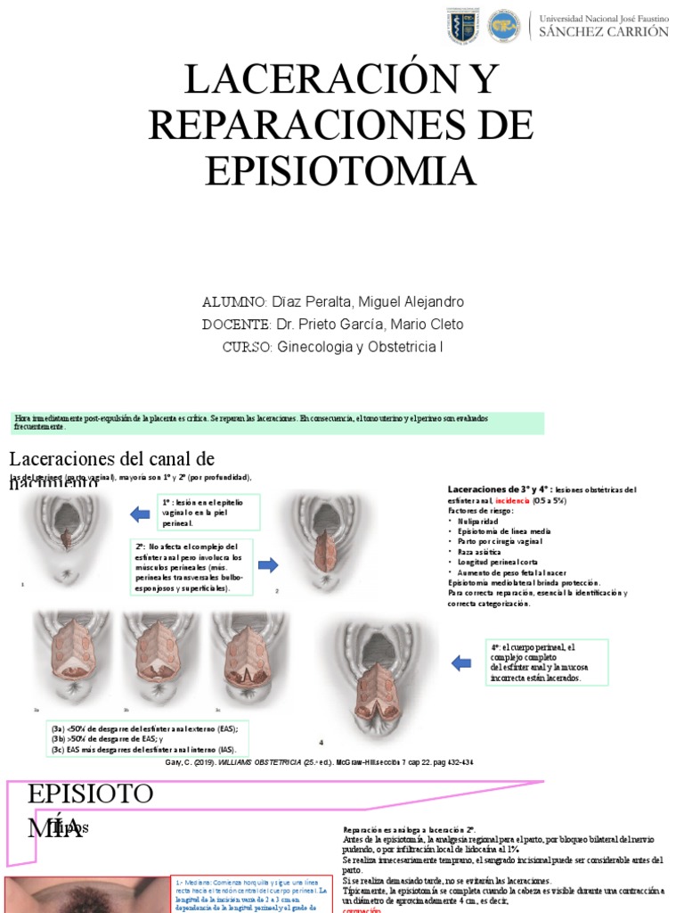 LACERACIÓN Y REPARACIONES DE EPISIOTOMIA | PDF | Parto | Especialidades ...