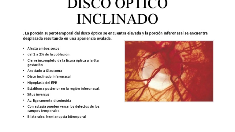 DISCO OPTICO INCLINADO Completo | PDF