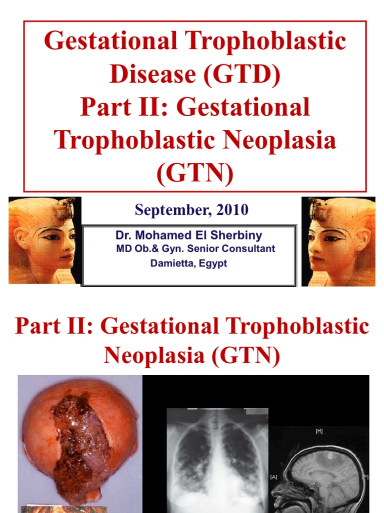Gestational Trophoblastic Disease Pt2 | Metastasis | Cancer