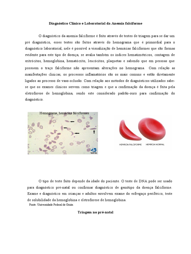 Diagnóstico da Anemia Falciforme: Triagem, Testes Laboratoriais e ...