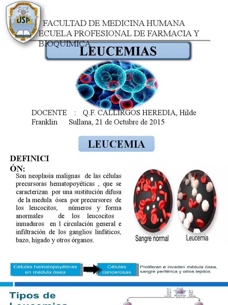 LEUCEMIAS | PDF | Leucemia | Leucocito