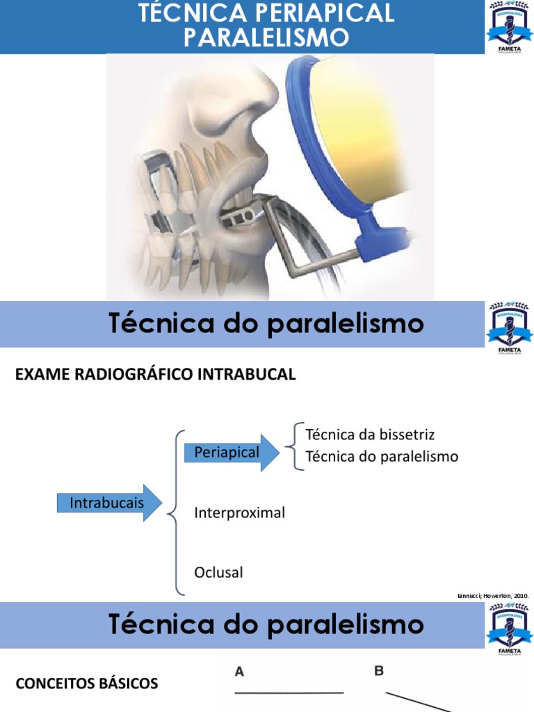 Técnica Periapical Do Paralelismo | PDF | Dente