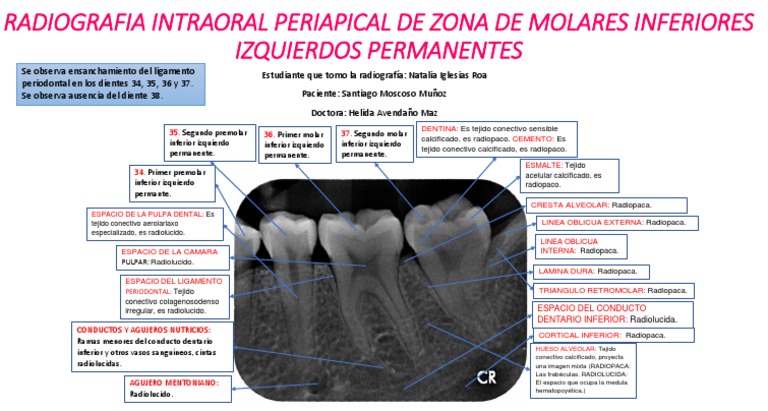 RX Molares Inf | PDF | Anatomía | Anatomia dental