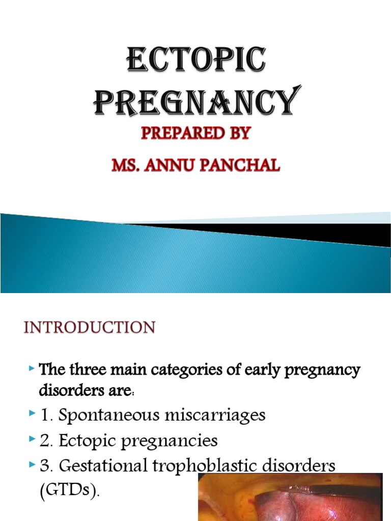 Ectopic Pregnancy | PDF | Pregnancy | Gynaecology