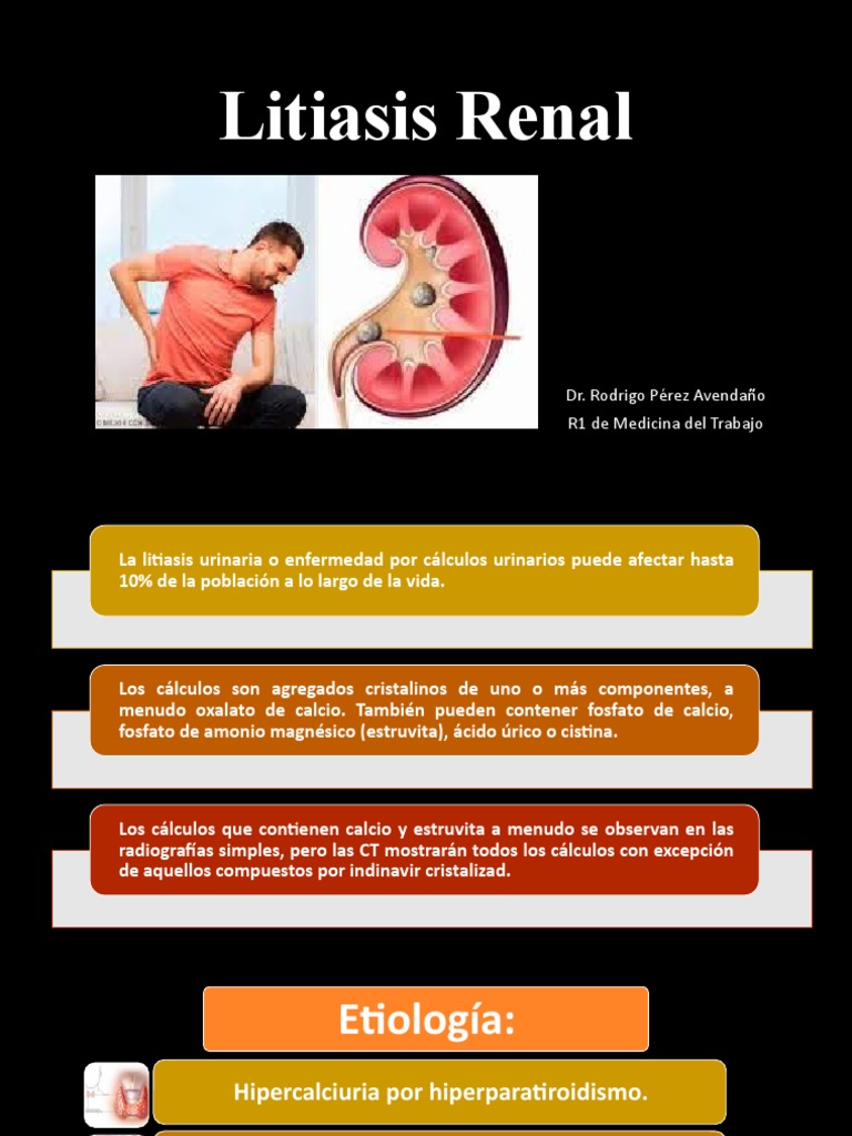 Litiasis Renal | PDF | Medicina CLINICA | Especialidades Medicas
