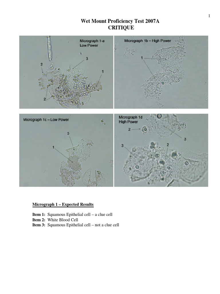 Analysis and Identification of Microscopic Samples from a Wet Mount ...