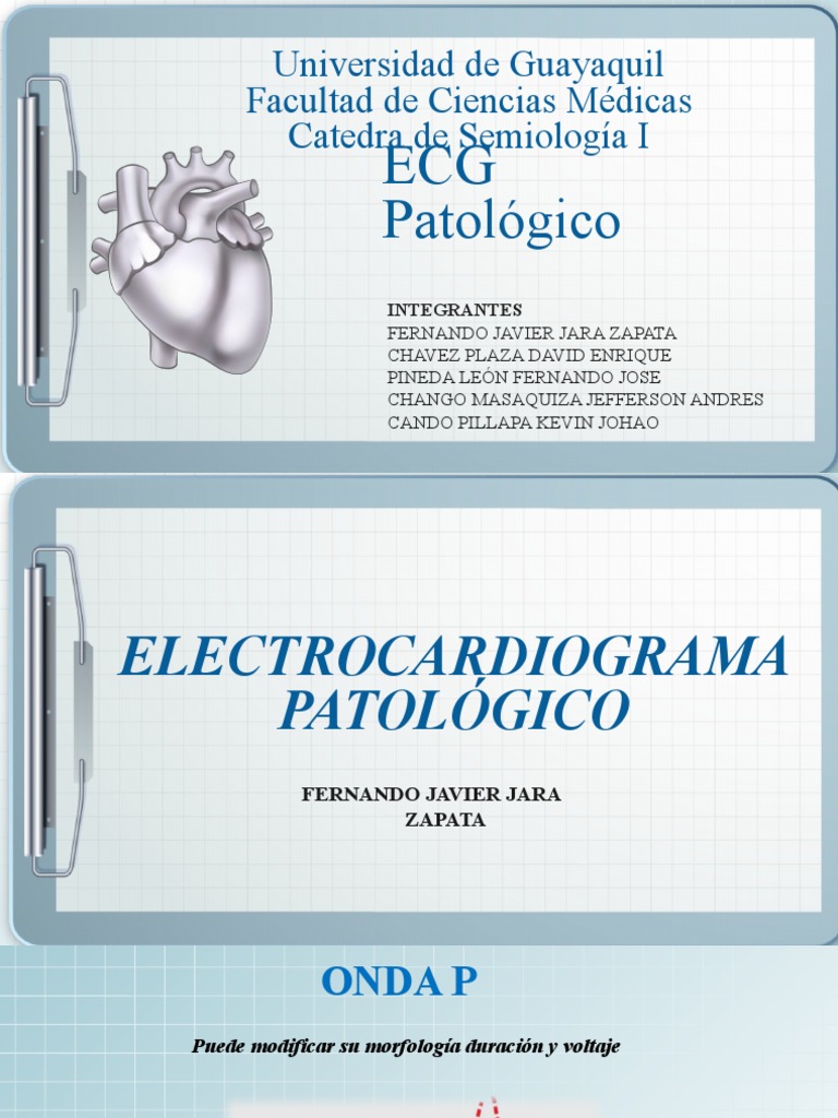 Grupo 11 - ECG Patologico | PDF | Electrocardiografia | Sistema cardiovascular