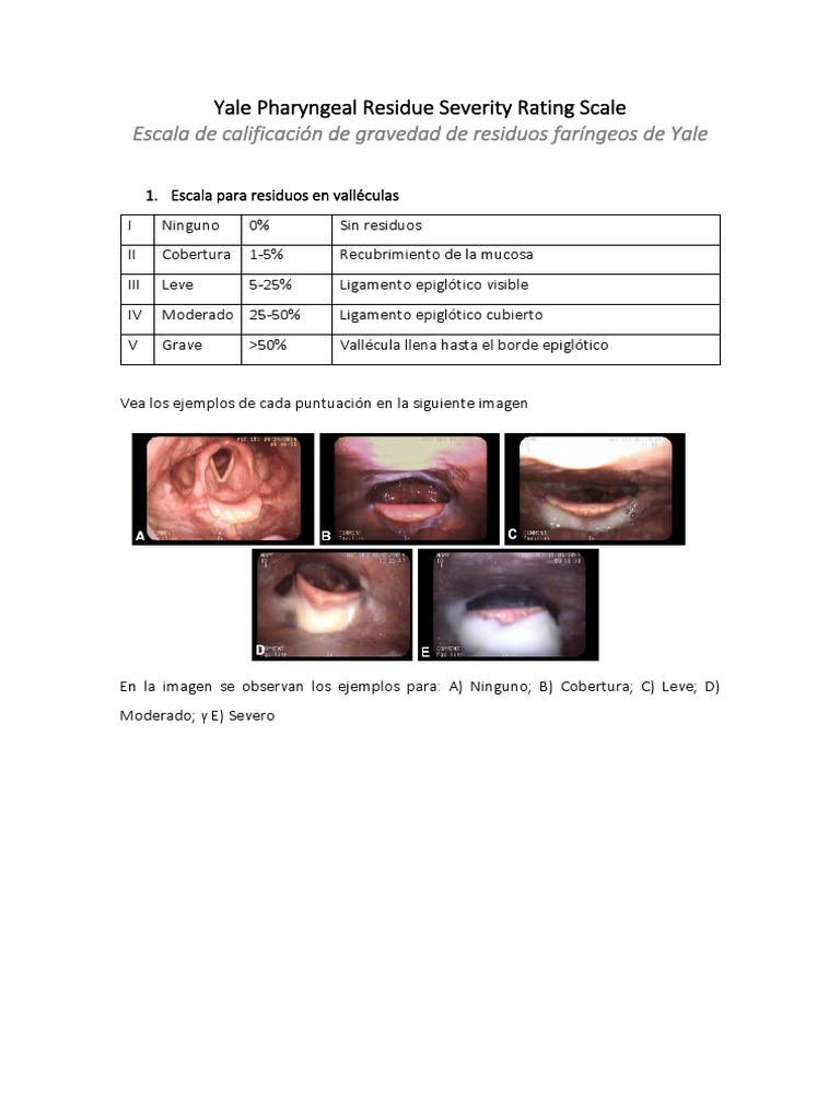 Yale Pharyngeal Residue Severity Rating Scale | PDF