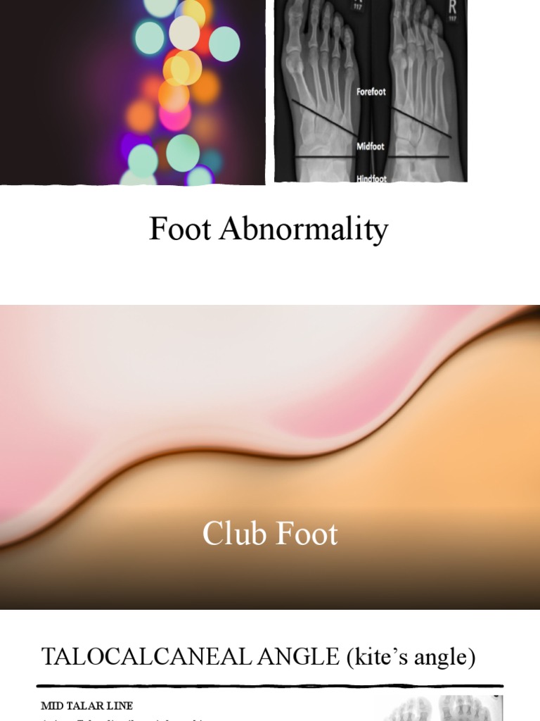 Foot Abnormality | PDF | Foot | Lower Limb Anatomy