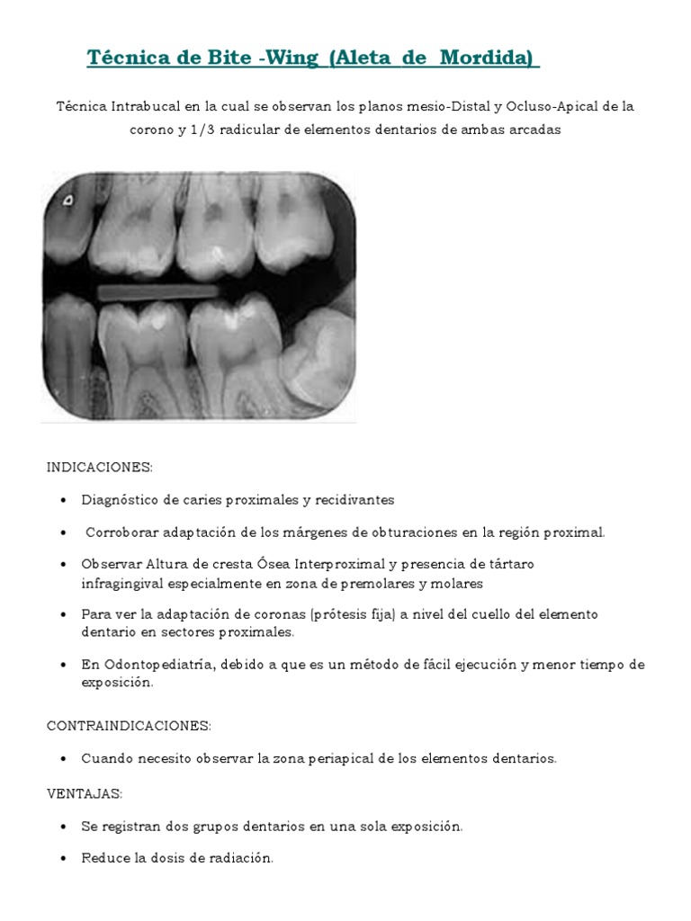Técnica De Bite Wing Pdf