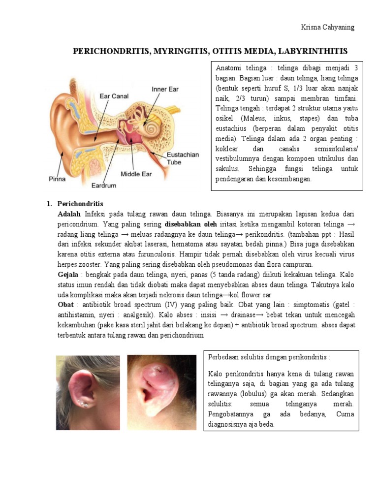 PERICHONDRITIS | PDF