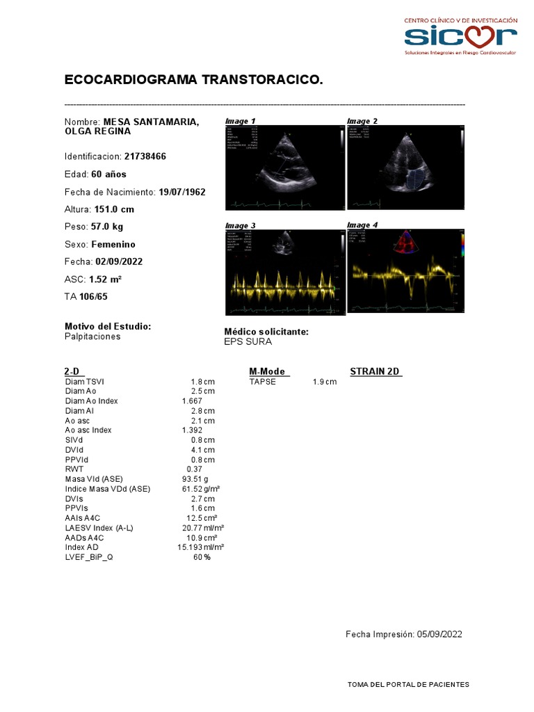 21738466-02092022-Ecocardiograma Doppler | PDF | Sistema cardiovascular ...