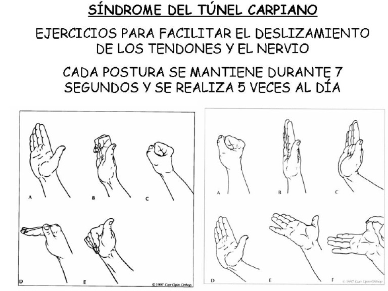 03 Ejercicios Del Sindrome Del Tunel Carpiano Pdf