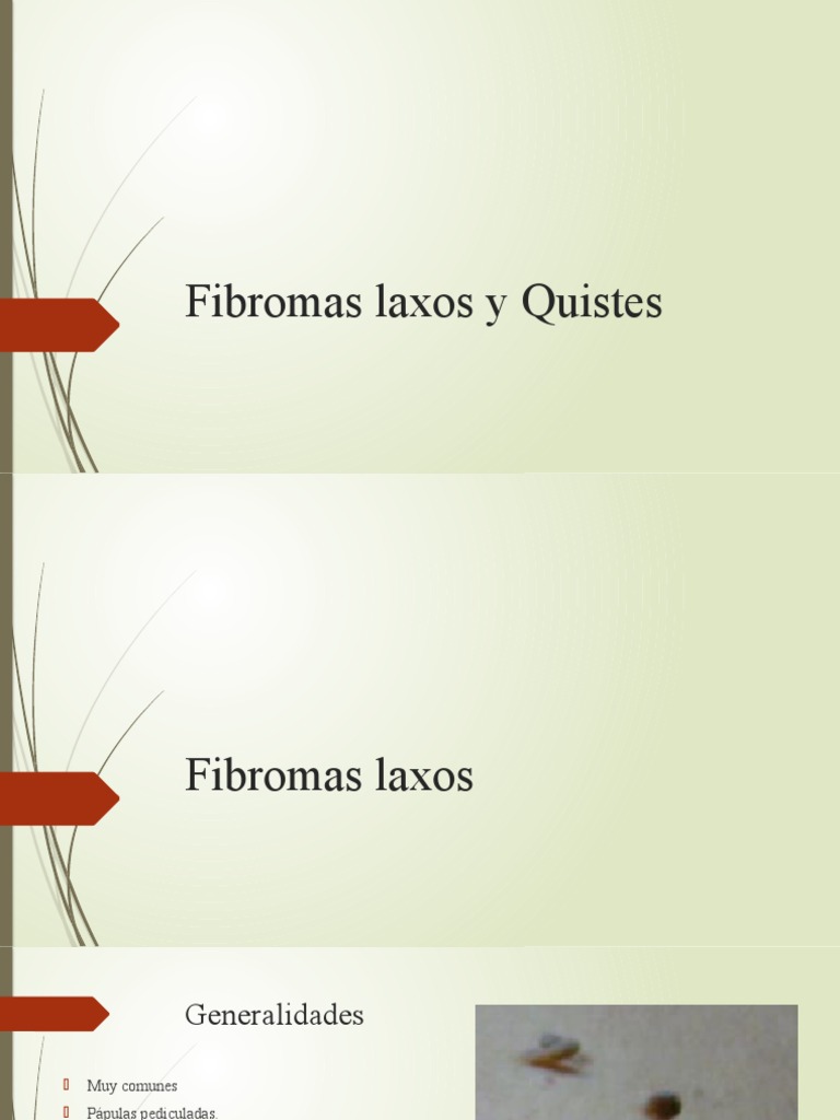 Fibromas y Quistes: Diagnóstico y Tratamiento | PDF | Epitelio | Medicina