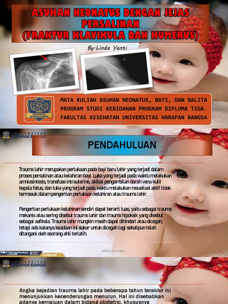 4 Fraktur Klavikula Dan Humerus | PDF