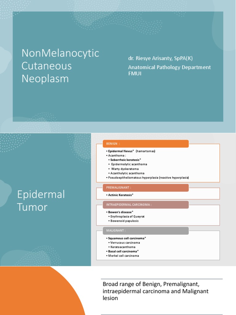 NonMelanocytic Cutaneous Neoplasm 2021 | PDF | Epidermis | Causes Of Death