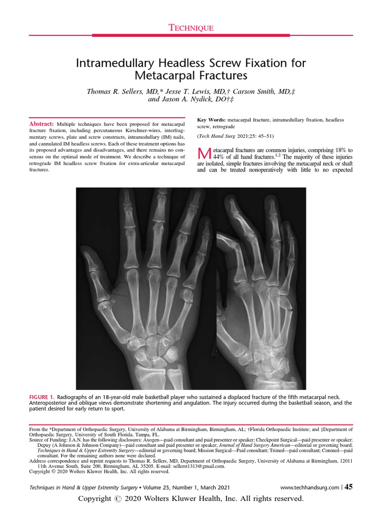 Intramedullary Headless Screw Fixation For Metacarpal Fractures Pdf Hand Surgery