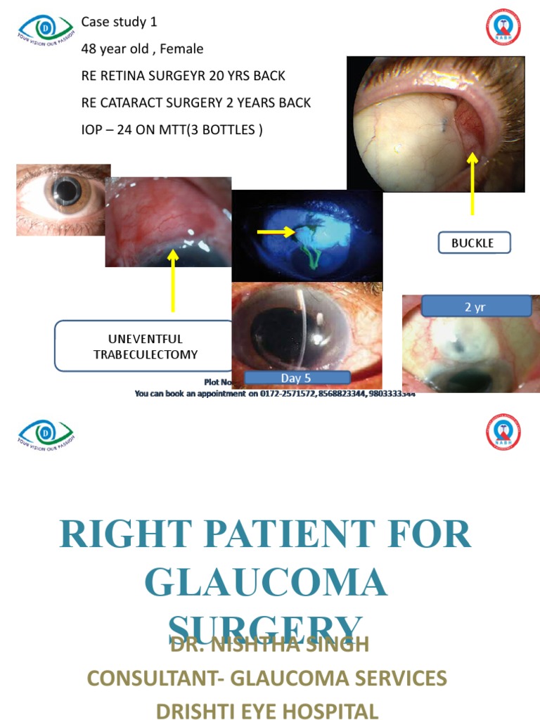 Glaucoma Surgery DR NISHTHA | PDF | Glaucoma | Clinical Medicine