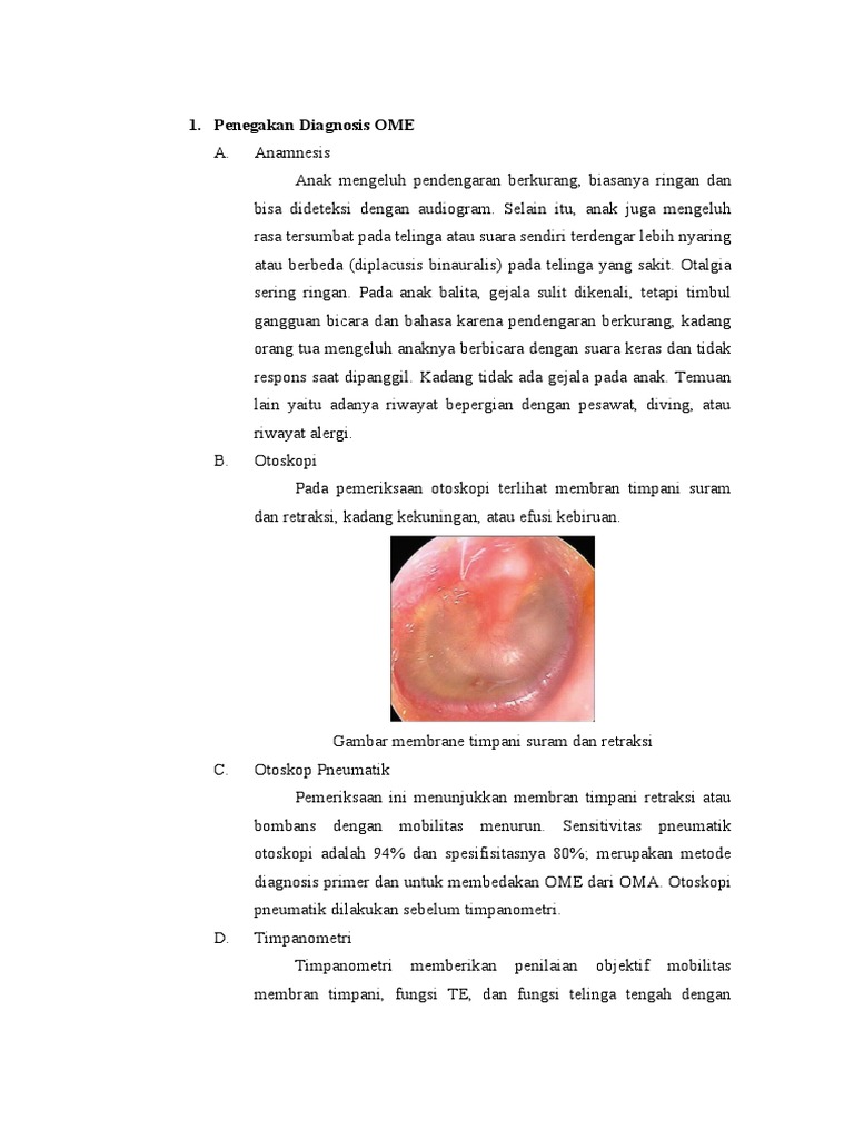Penegakan Diagnosis OME | PDF