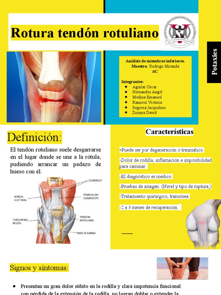Rotura del Tendón Rotuliano: Síntomas y Tratamiento | PDF | Rodilla ...