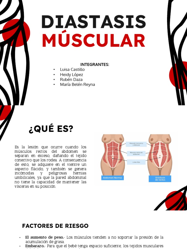 Diastasis Muscular 28.06 | PDF | Abdomen | Medicina CLINICA