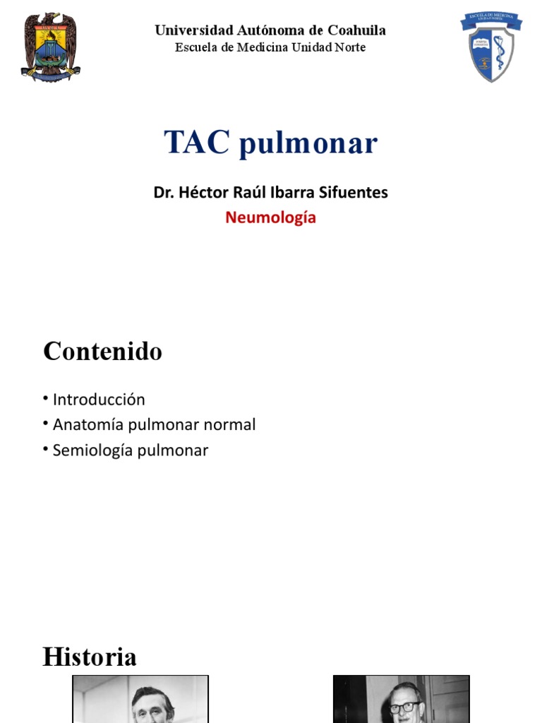 TAC Pulmonar | PDF | Ct Scan | Pulmón