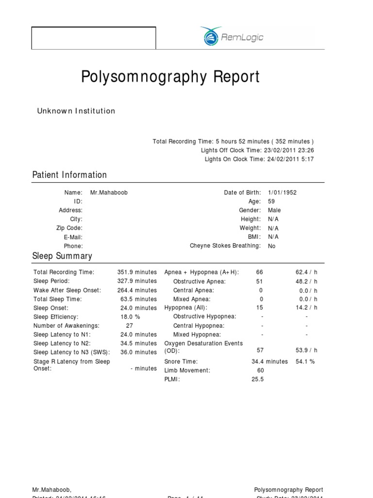 Polysomnography Report | Heart Rate | Sleep