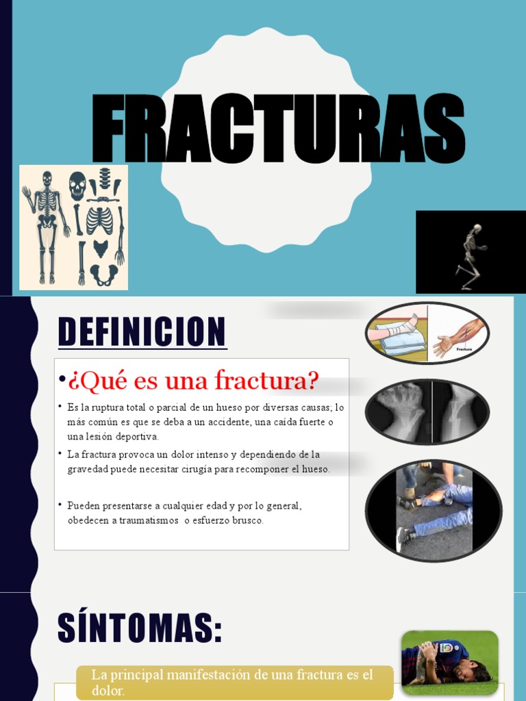 FRACTURAS | PDF | Hueso | Primeros auxilios
