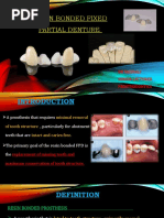 Finish Lines in FPD | PDF | Mouth | Dentistry
