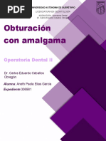 Alkasite Una Nueva Alternativa para Amalgama Reposte de Caso Clinico ...