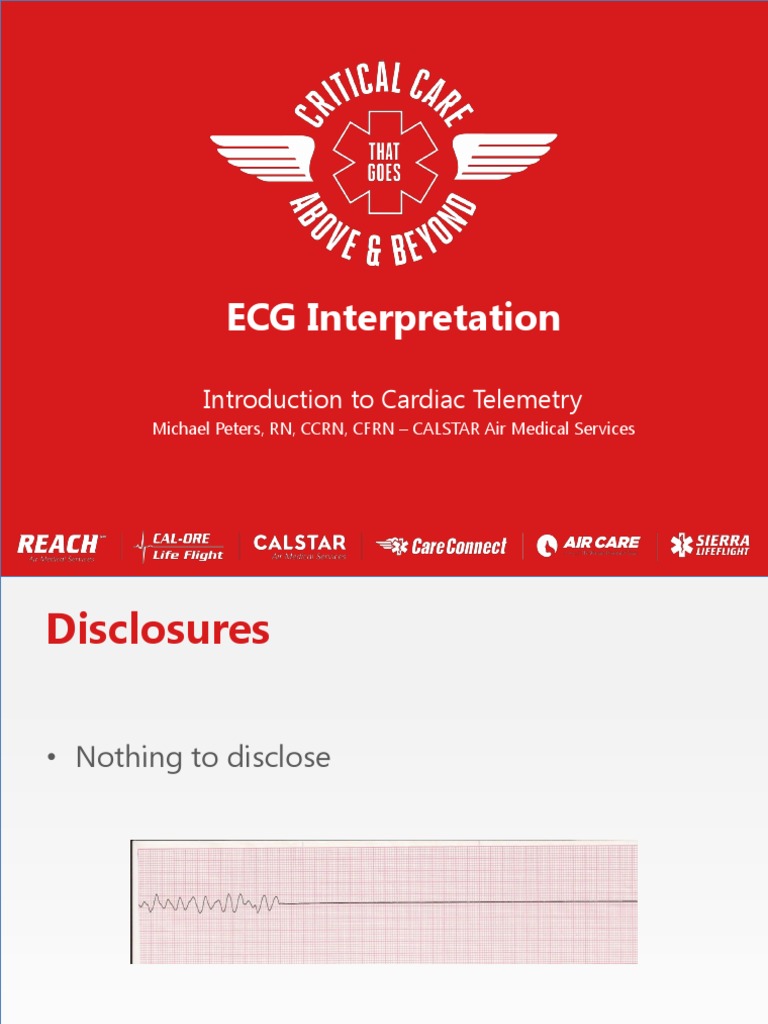 Ecg Interpretation New Template | PDF | Electrocardiography ...